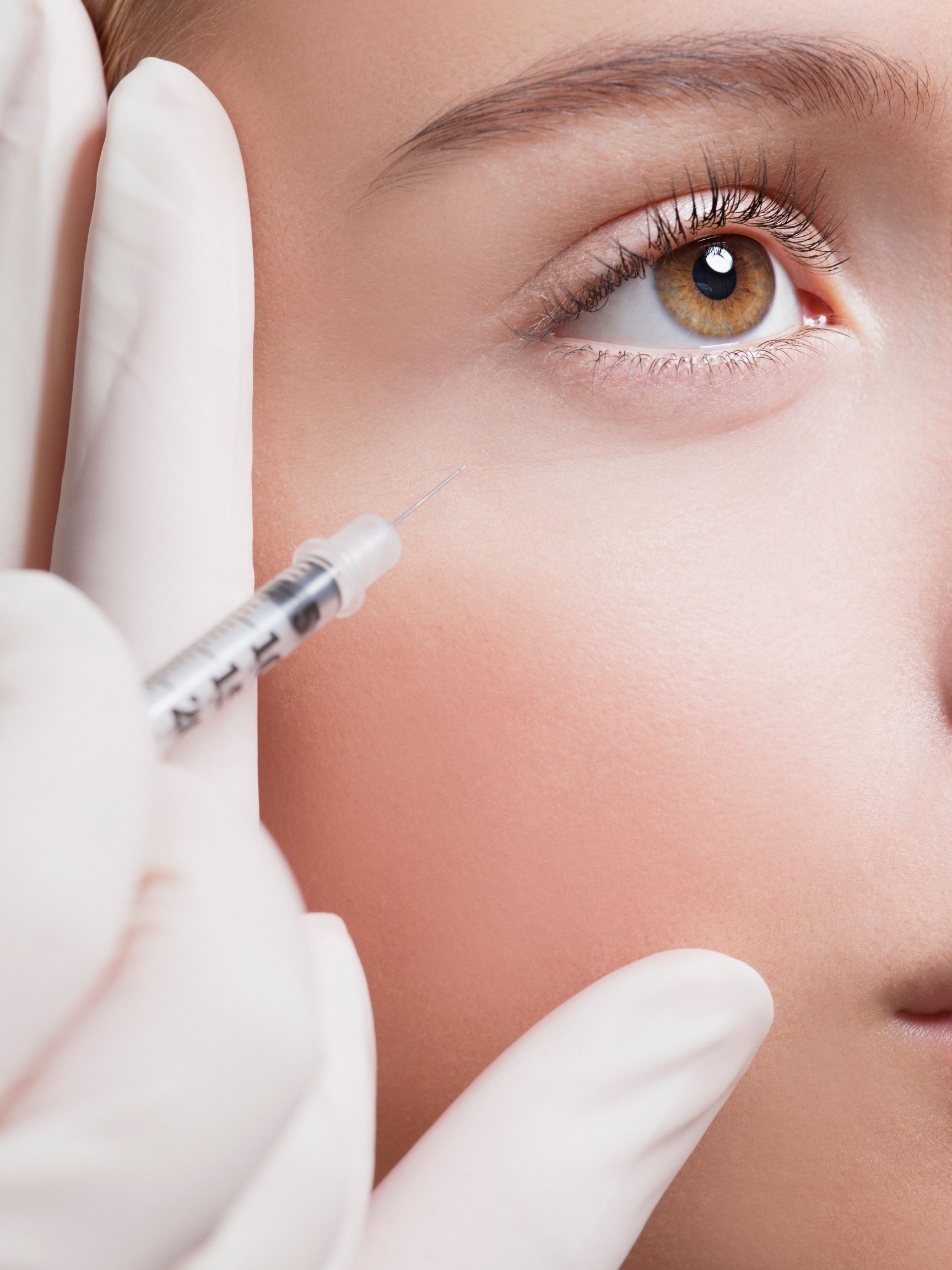 The Ultimate Guide to Under-Eye Filler in Silver Spring, MarylandW Med Spa