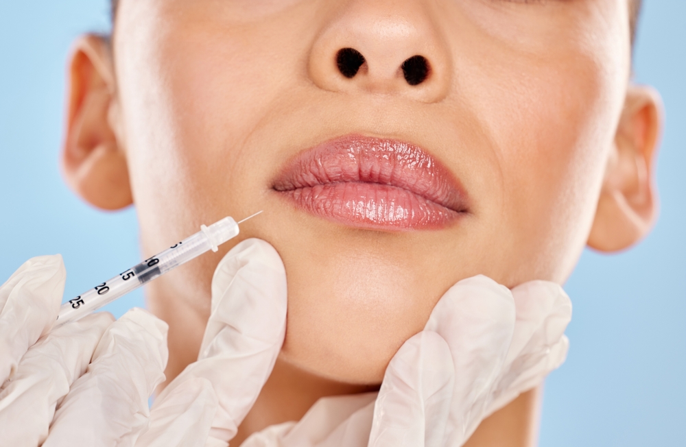 7 Secrets to Natural Dermal Filler ResultsW Med Spa